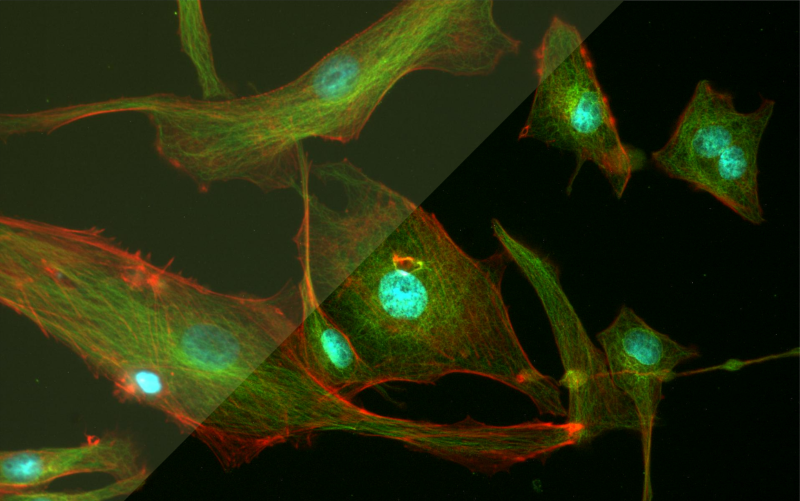 Automated multi-channel epifluorescence microscopy - Zaber