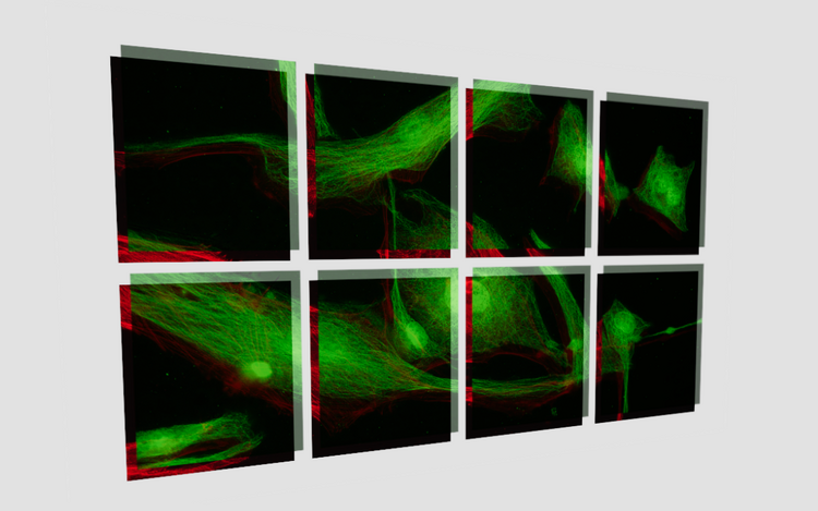 Easily automate multi-dimensional image acquisition with free Zaber