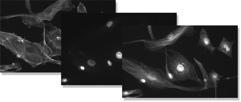 Automated multi-channel epifluorescence microscopy - Zaber